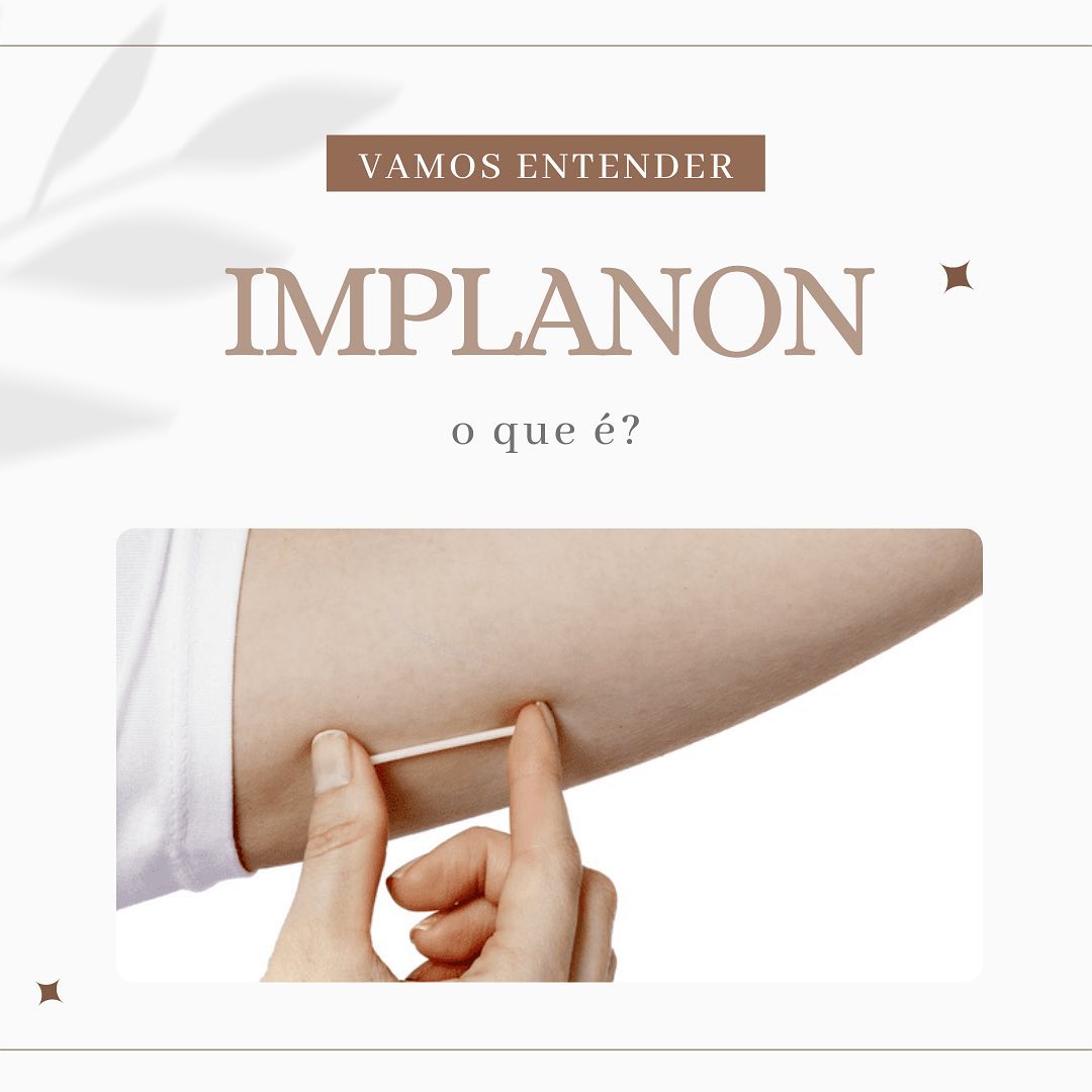 Implanon- O que é? - Dra. Victória Higashibara